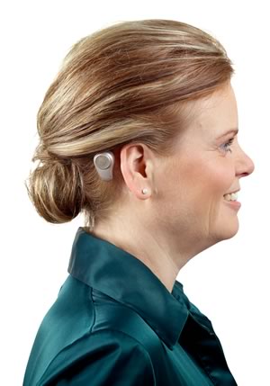 Bone Anchored Hearing Implant (Baha) | Ear Institute of Chicago
