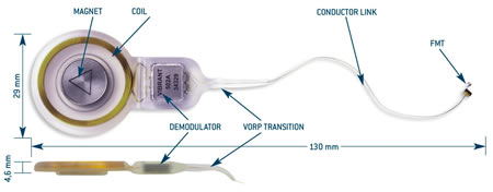 Vibrant Soundbridge | Ear Institute of Chicago